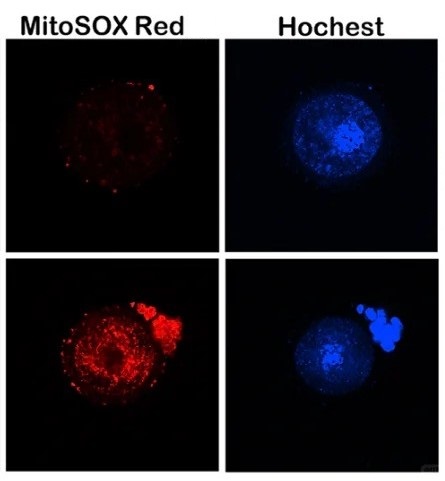 MitoSOX Red（线粒体超氧化物检测红色荧光探针） - 知凡生物-科研试剂 l 官网