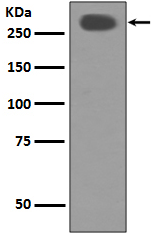 ACC1 Antibody - 知凡生物-科研试剂 l 官网