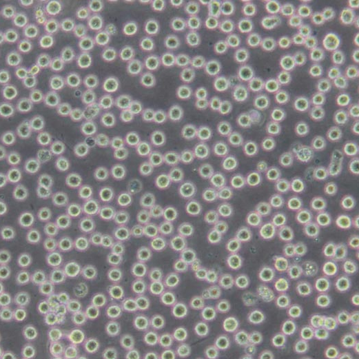 H22(小鼠肝癌细胞，STR)