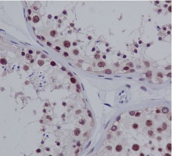 PIAS1+PIAS2+PIAS3 Antibody - 知凡生物-科研试剂 l 官网