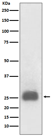 TIMP1 Antibody - 知凡生物-科研试剂 l 官网