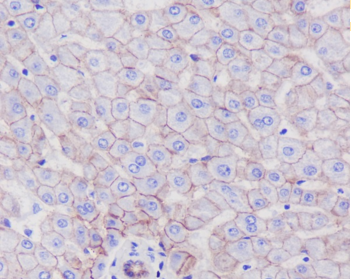 SCARB1 Antibody - 知凡生物-科研试剂 l 官网