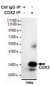 CDX2 Mouse mAb - 知凡生物-科研试剂 l 官网