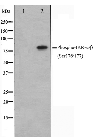 Phospho-IKK- alpha (Ser176) /IKK- beta (Ser177) Antibody - 知凡生物-科研试剂 l 官网