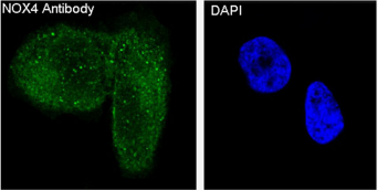 NOX4 Antibody - 知凡生物-科研试剂 l 官网