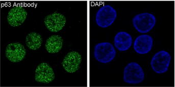 p63 Antibody - 知凡生物-科研试剂 l 官网